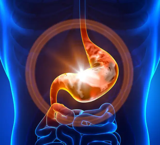 Gastritis: 10 ihe kpatara ọdịdị ya