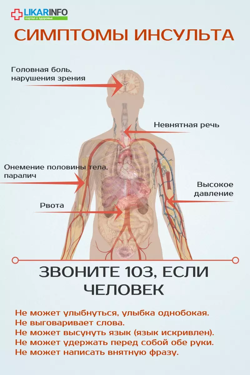 Причини, що викликають інсульт, різні, і залежать від різновиду захворювання. Існує 2 види інсульту.