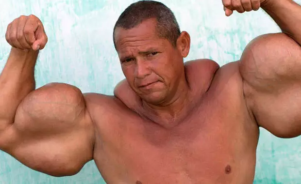 Angenfilod Synthol Anhygoel Hulk