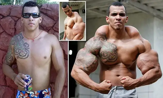 Os incríveis monstros Hulk Synthol