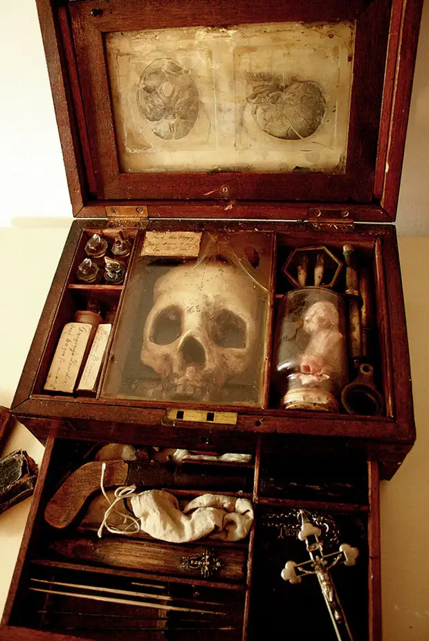 Londondagi eski uyning podvalida sirli mavjudotlarning skeletlari topildi