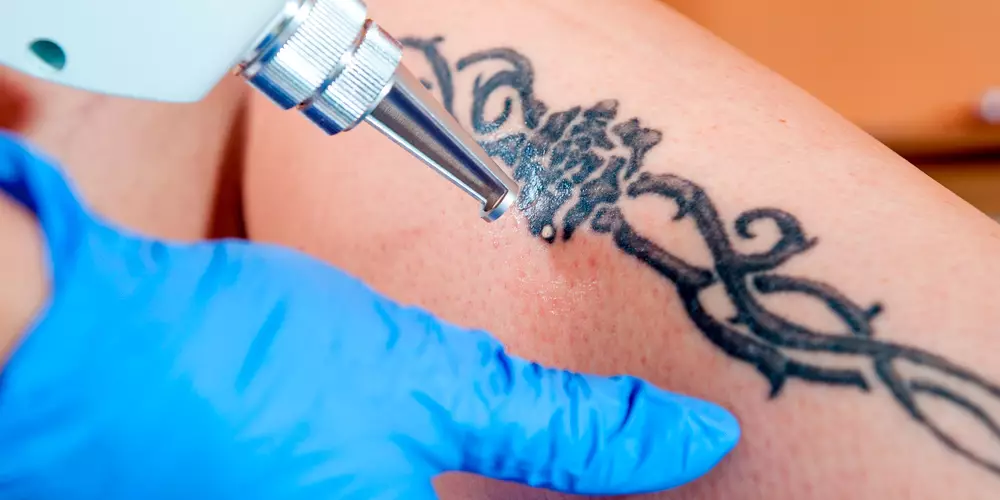 Beauté dangereuse : ce qu'il faut savoir avant de se faire tatouer