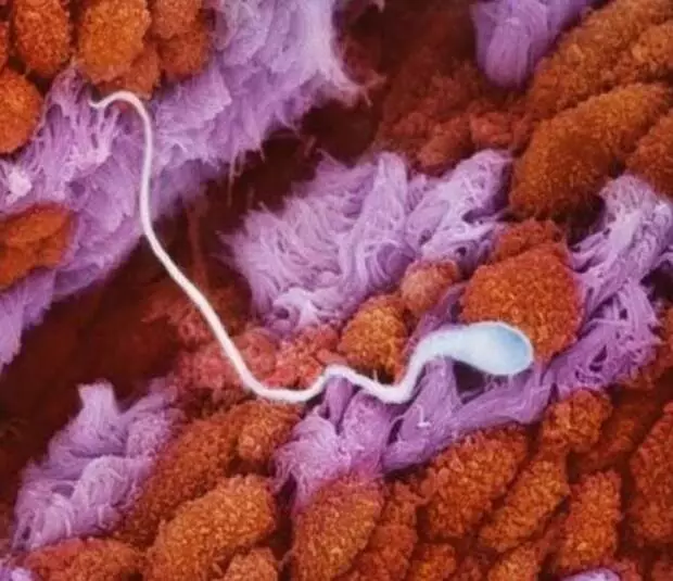 Μοναδικές φωτογραφίες της εξέλιξης του ανθρώπινου εμβρύου από τη σύλληψη έως τη γέννηση