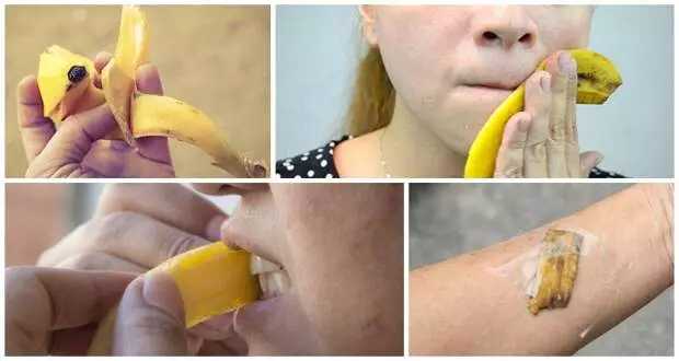 香蕉皮的秘密会让你大吃一惊！