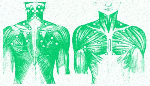 Myofascial قويۇپ بېرىش: سىزگە لازىممۇ ۋە ئۇنى قانداق ئەمەلگە ئاشۇرۇش كېرەكمۇ؟