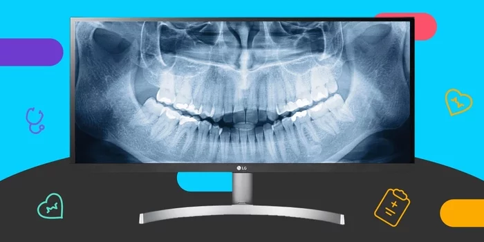 Brève histoire de l'imagerie médicale : de la radiographie à l'intelligence artificielle Longpost