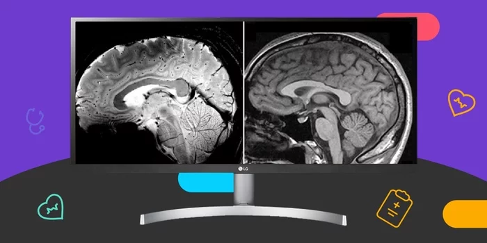 Uma breve história da imagem médica: do raio-X à inteligência artificial Longpost