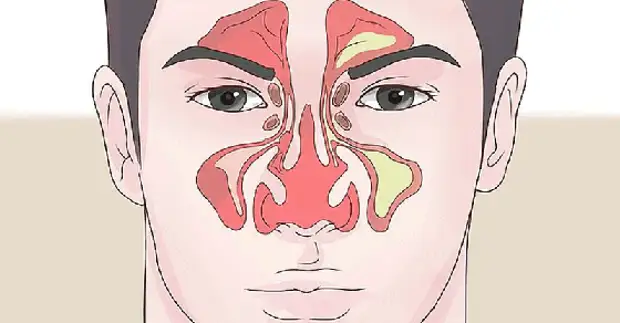 Stuffy nose - procedures