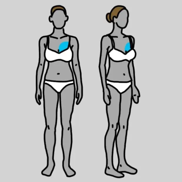 mgbaàmà hypothyroidism