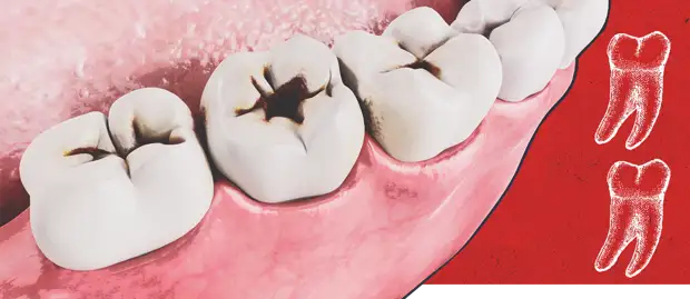 4 problemas dentários que você precisa corrigir o mais rápido possível