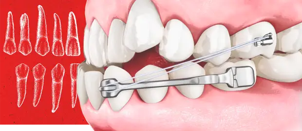 4 problemas dentales que debes solucionar lo antes posible