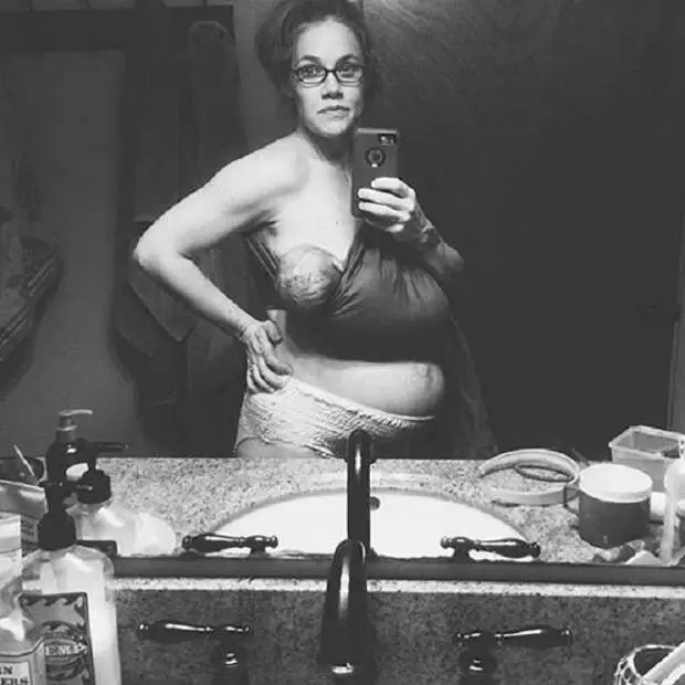 Šādi izskatās sievietes ķermenis 24 stundas pēc dzemdībām ... Šokējošs foto!
