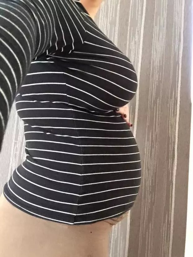 หญิงคนนี้พยายามจะตั้งครรภ์ลูกคนที่สาม แต่การสแกนด้วยอัลตราซาวนด์พบว่ามีเด็กอยู่ในท้องมากขึ้น