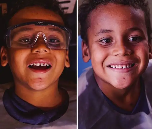 Бразилският зъболекар пътува безплатно и лекува зъбите на бедните хора