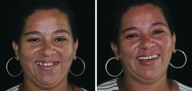 Dokter gigi Brasil lelungan lan ngobati untu kanggo wong miskin kanthi gratis