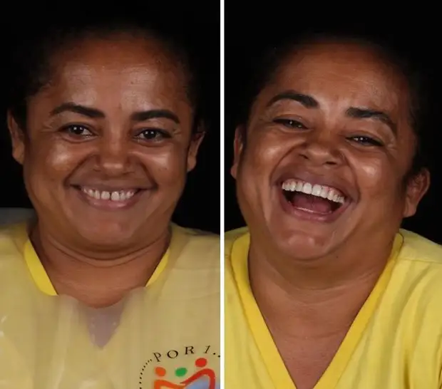 Nha sĩ Brazil đi khám và chữa răng miễn phí cho người nghèo