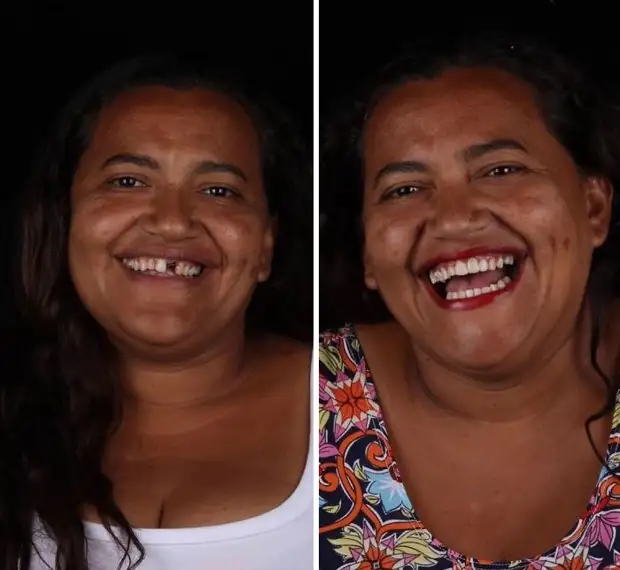 Nha sĩ Brazil đi khám và chữa răng miễn phí cho người nghèo