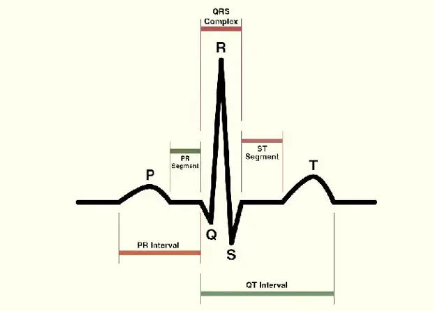 心臓の心電図とその解読-それがどのように行われ、どのような場合に行われるか