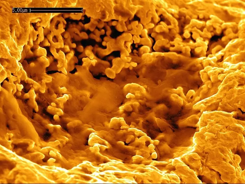 Cupriavidus metallidurans kwayoyin cuta ne marasa spore-gram-korau (kwayoyin haƙuri na ƙarfe) wanda ya samo asali don daidaitawa da yawan ion ƙarfe mai nauyi a cikin mahalli.