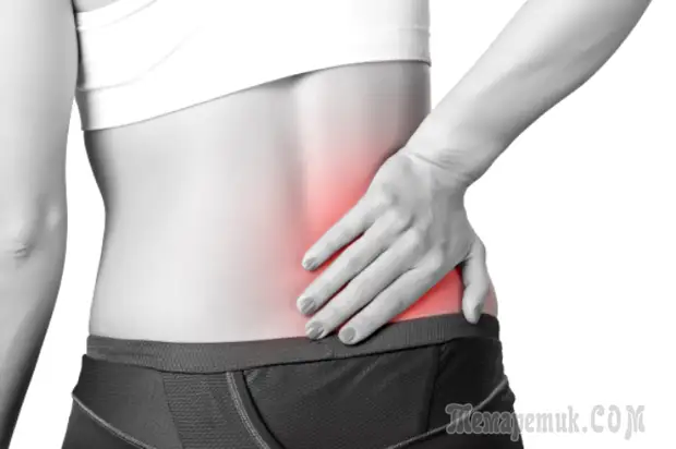 Sciatica, awọn aami aisan ati itọju pẹlu awọn atunṣe eniyan