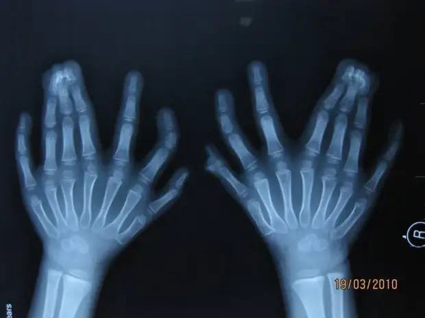 rentgen 120 let starý, nejzajímavější rentgeny, šokující rentgeny