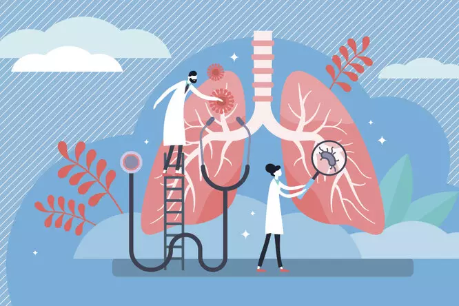 Wéi asymptomatesch Pneumonie ze definéieren? 5 Haaptschëlder