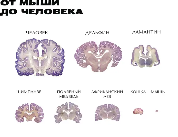 Mozak je jednostavno složen