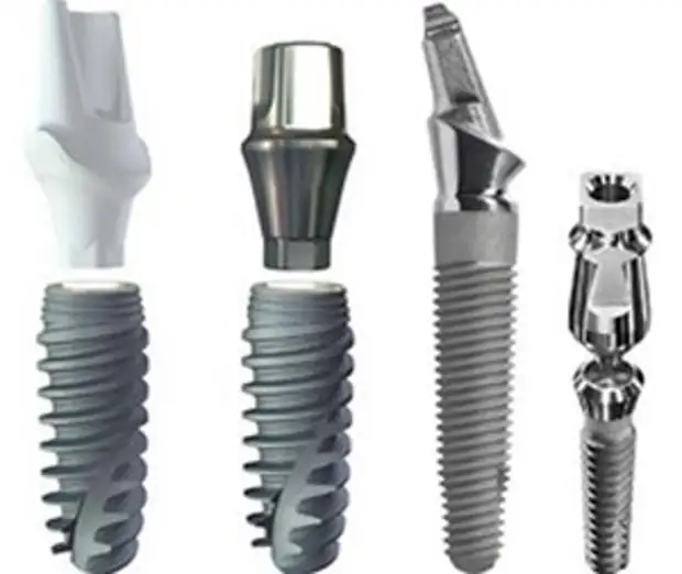 types of dental implants