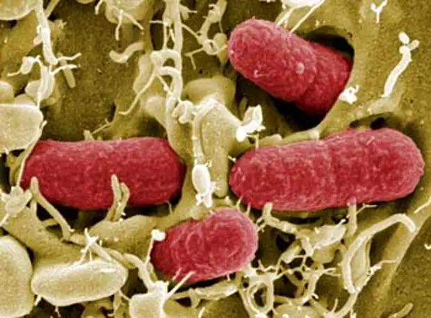 Escherichia coli.