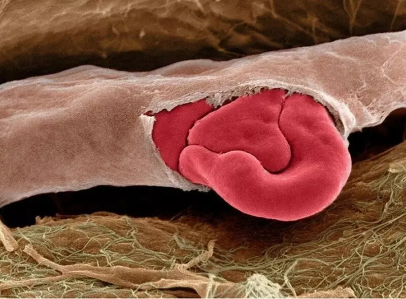 10. E este é un capilar danado con glóbulos vermellos no seu interior