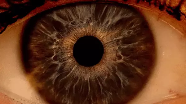 5. Neste vídeo, seguindo ao optometrista, podes mirar a pupila dilatada do ollo