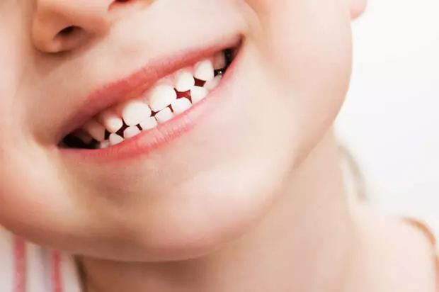 દાંત પીસવા: કારણો અને સારવાર