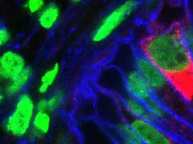 Awọn sẹẹli ti ẹya organoid inu labẹ maikirosikopu fluorescence kan. Aworan ti Cincinnati Children's Hospital Medical Centre