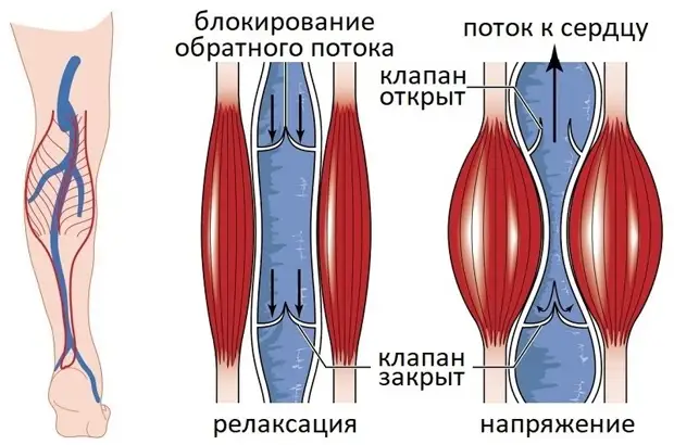 Varices - compensación para camiñar erguido