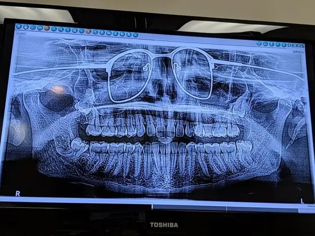 18 X-ray da ke ba ku ƙarin bayani game da jikin ku fiye da littafin koyarwa