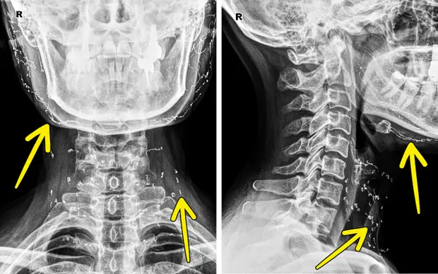 18 X-ray da ke ba ku ƙarin bayani game da jikin ku fiye da littafin koyarwa