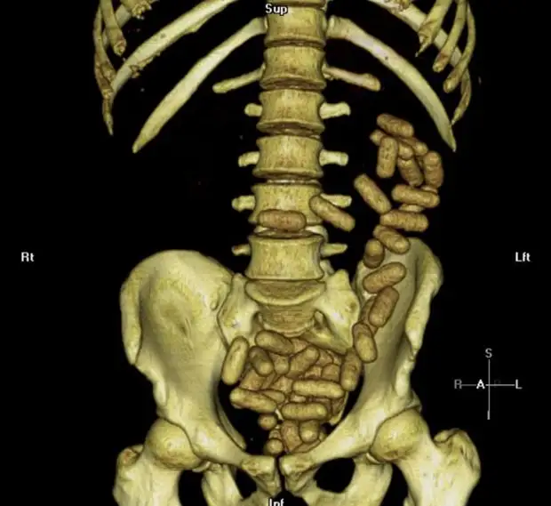 18 X-ray da ke ba ku ƙarin bayani game da jikin ku fiye da littafin koyarwa