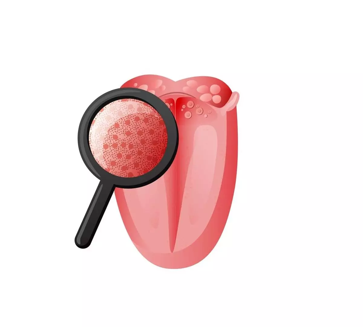 There are thousands of taste buds on the surface of the tongue.