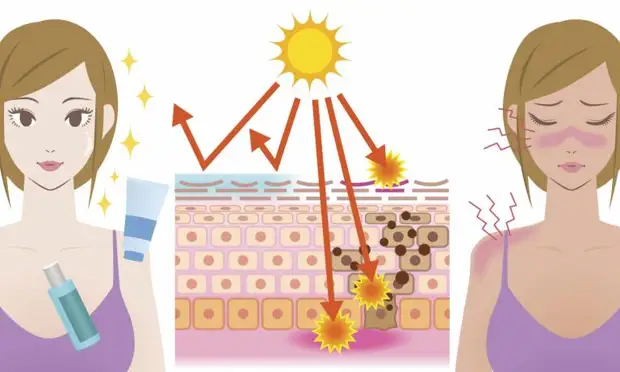 la efiko de sunlumo sur la haŭto