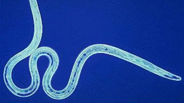 25 parasites les plus inhabituels et dangereux