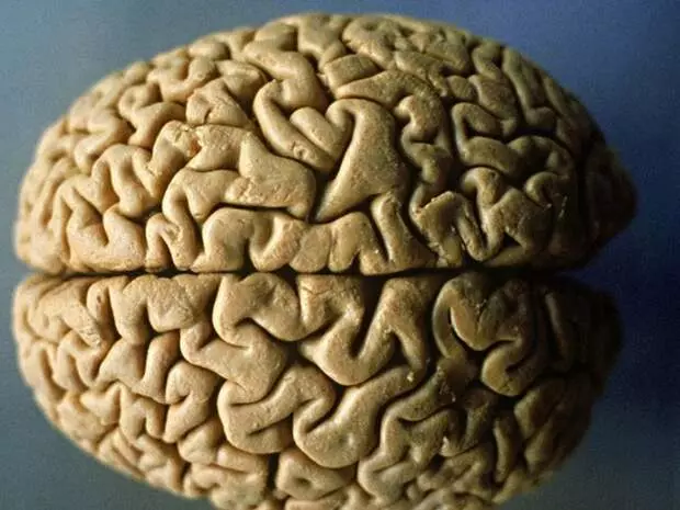سائنسدان هڪ مئل انساني دماغ جي بحالي جو ڪم ڪندا