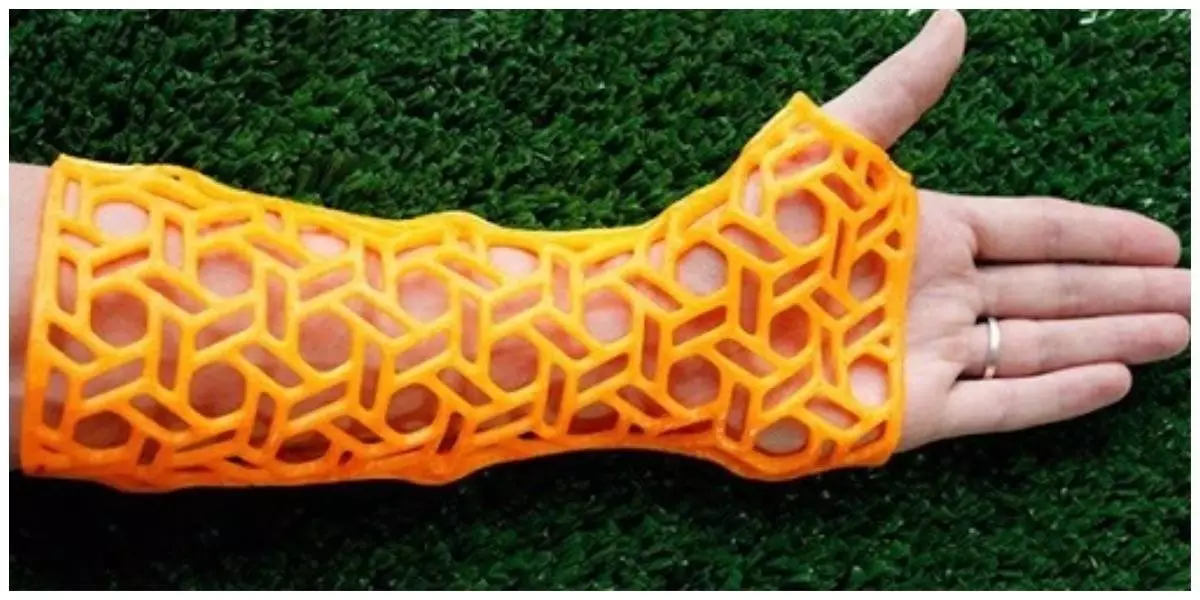 Tegenwoordig wint plastic gips gemaakt door 3D-printen - Cortex ook aan kracht.