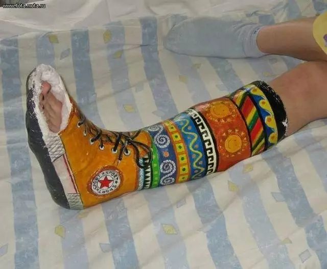 Innovatie in modern gips