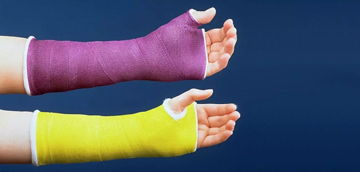 Kunststof gips is een verband geïmpregneerd met een speciale polymeersamenstelling