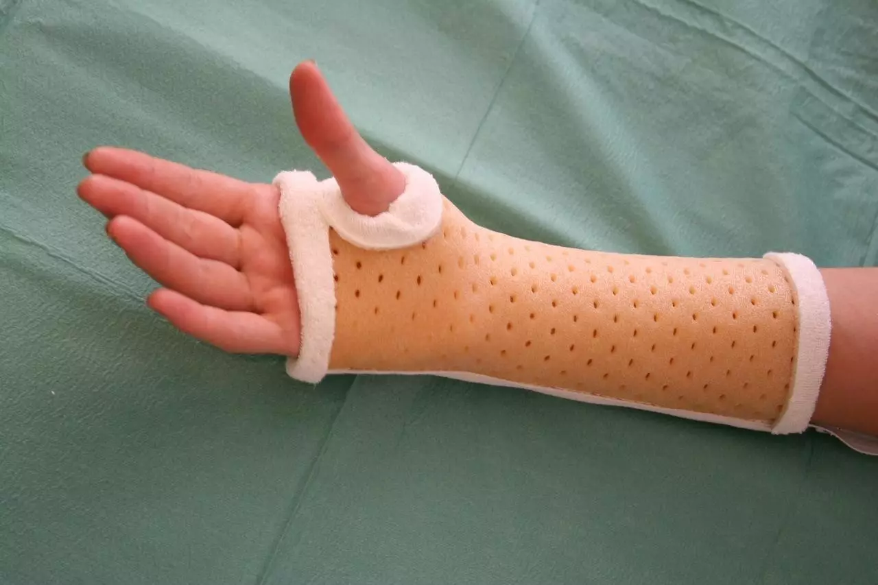 In tegenstelling tot klassiek gips weegt kunststof gips meerdere keren minder en belemmert het de beweging niet.