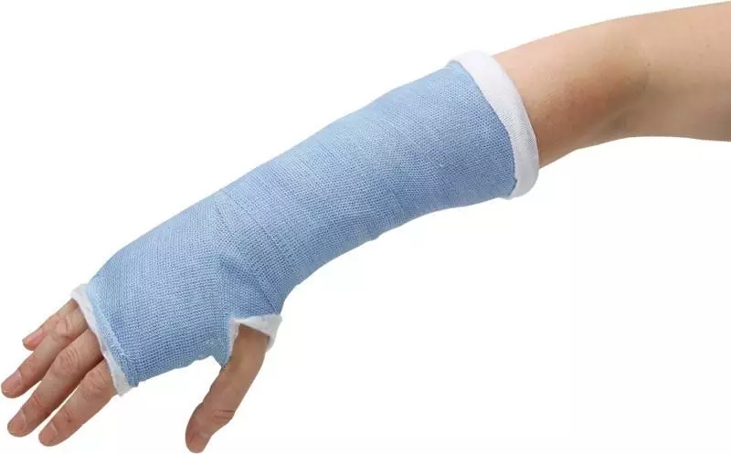 De meest bekende soorten moderne gips. Scotchkast