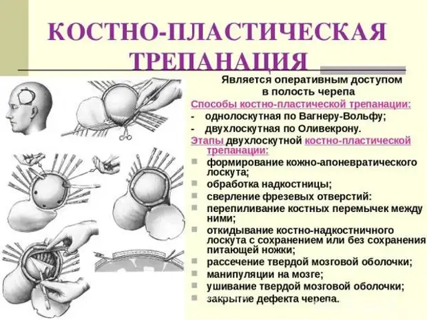 طب جراحات المخ ، طب ، مخ ، عملية ، بريد طويل ، نص ، صور ، قصدير