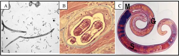 Parasitologi delicacy: trikinosis. Obat, Longpost, Parasit, Penyakit, Trichinosis, Scientaevulgaris