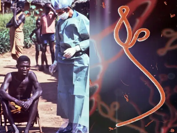Pandora's Box Keys: Ebola पेशंट शून्य. इबोला, मारबर्ग, इतिहास, औषधाचा इतिहास, औषध, रोग, महामारी, सायंटेव्हल्गारिस, लाँगपोस्ट