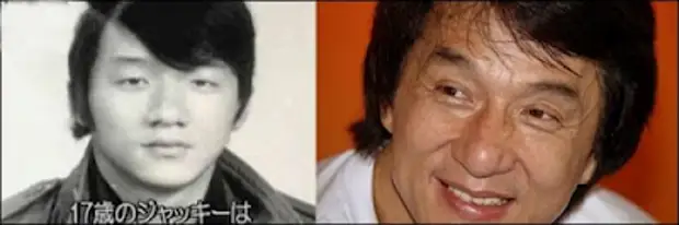 Operasi kelopak mata Jackie Chan